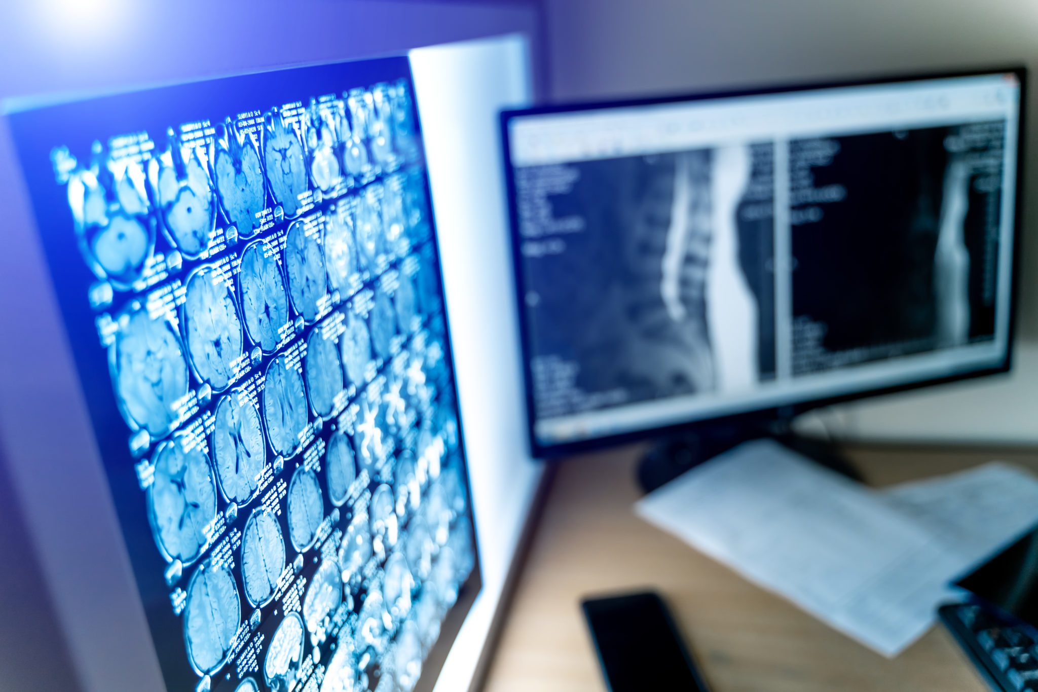 Ensuring Consistency in RECIST Reads: An Oncology CROs Guide